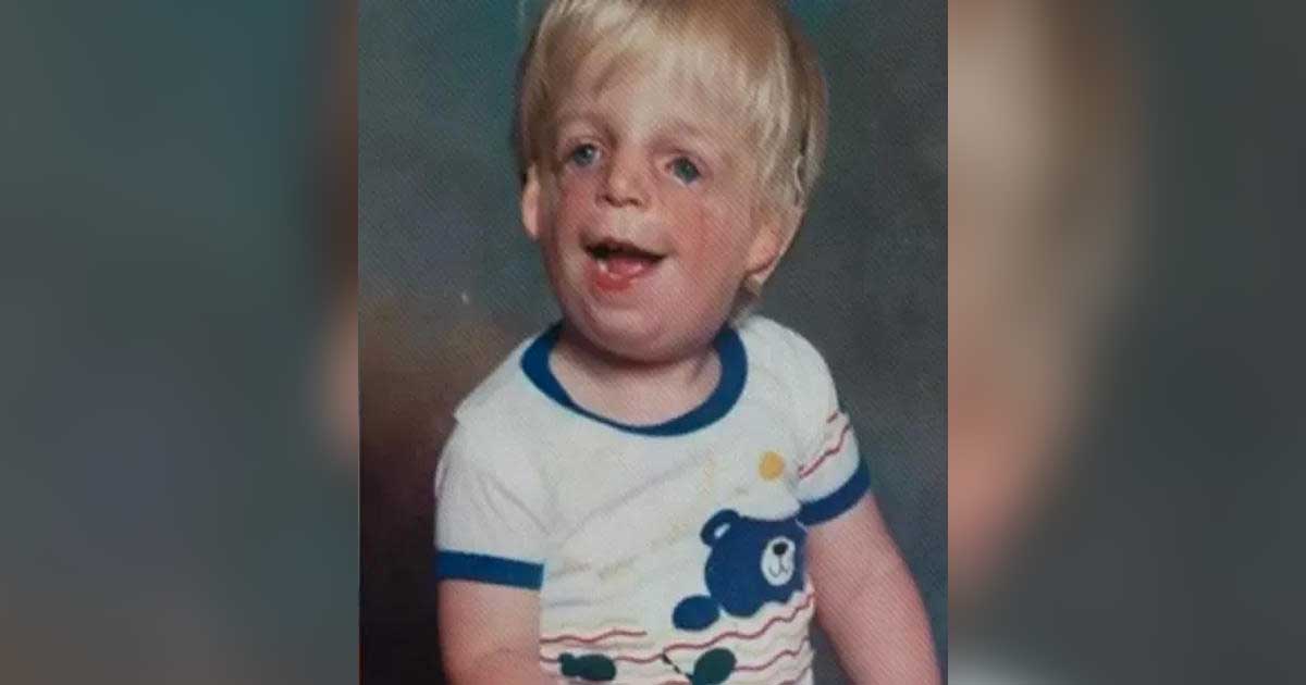 He Was Abandoned At Birth Because Of His 'Disfigured' Face - Look At ...